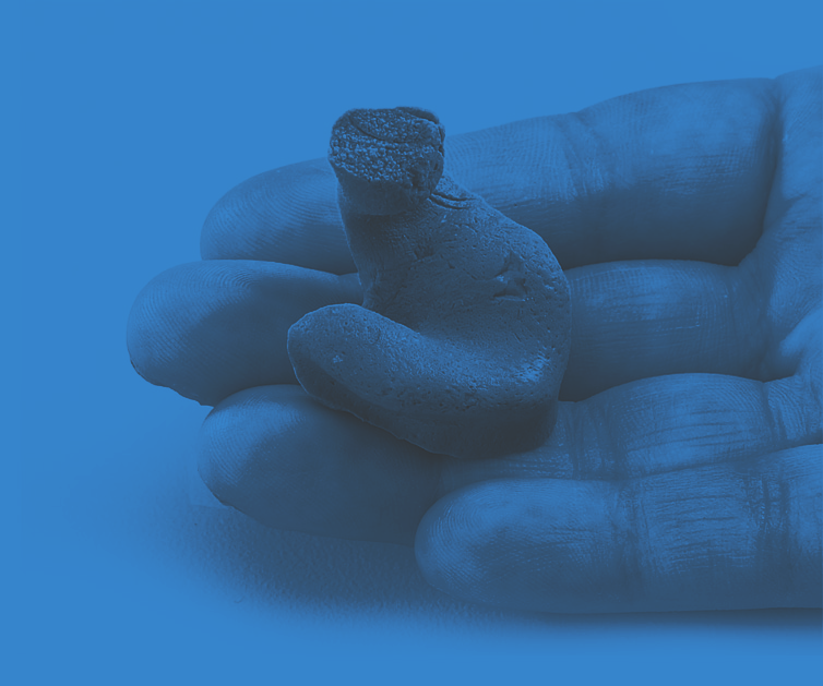 Plug-a-lug – | Hearing and ear protection services